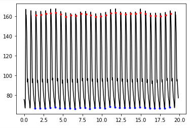 Unveiling the Potential of Photoplethysmography (PPG) in Critical Care ...