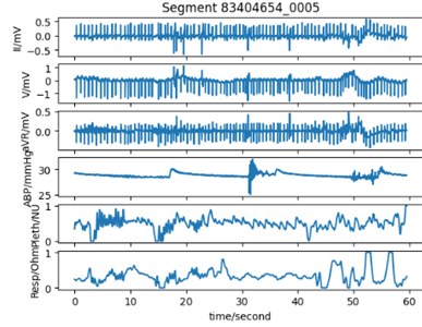 Unveiling the Potential of Photoplethysmography (PPG) in Critical Care ...